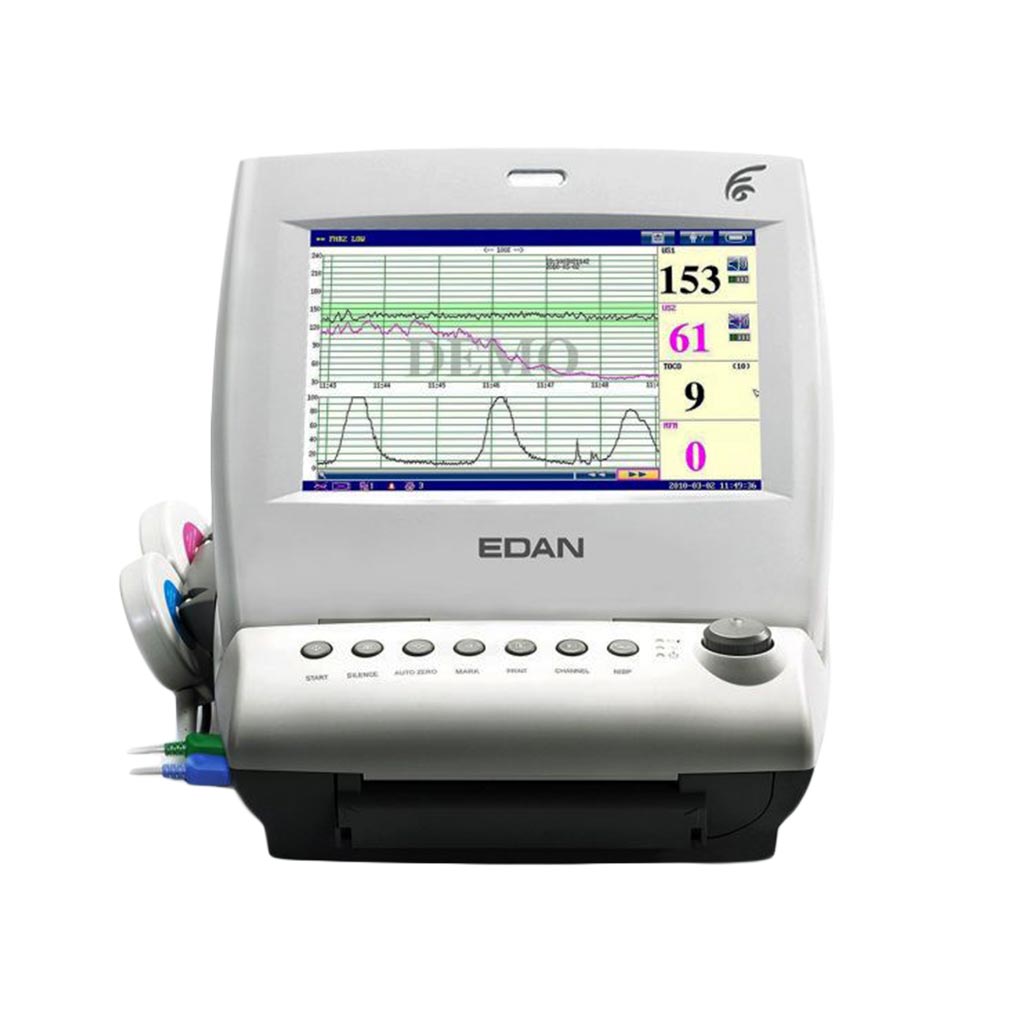 Fetal Monitoring System | Fetal Monitoring Devices