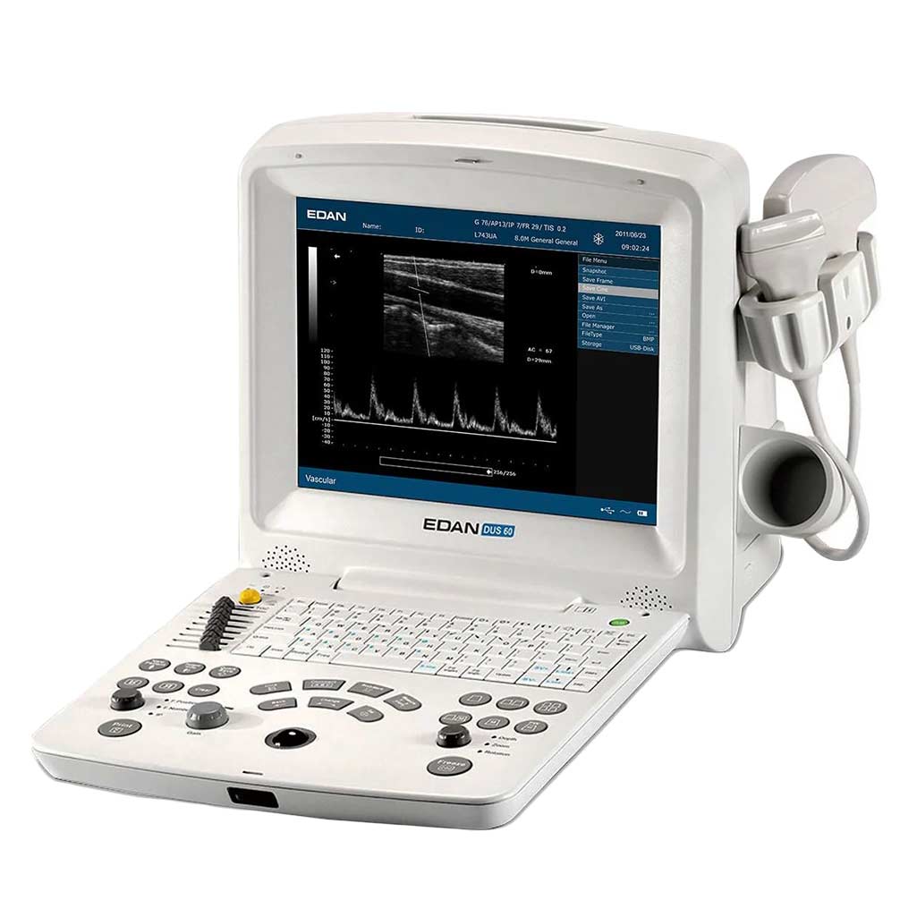 Edan Diagnostic Imaging Systems